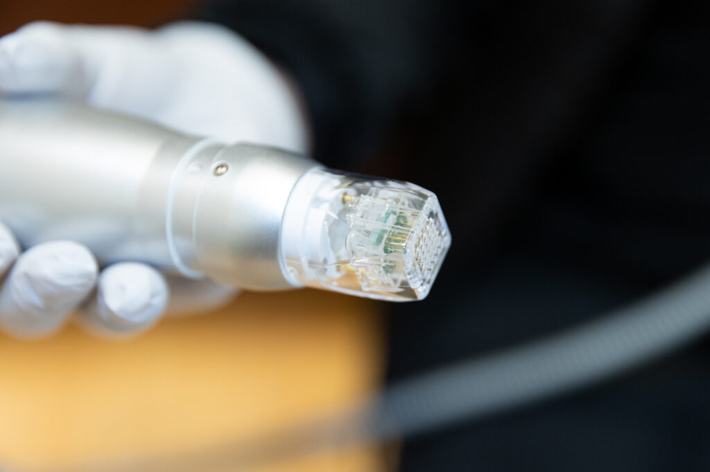 Microneedling Milwaukee | Best RF Microneedling Near Me